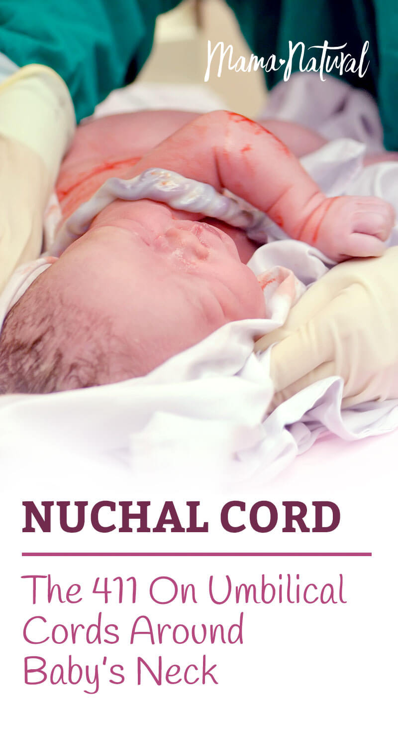The Truth About Nuchal Cords (Umbilical Cord Around Baby’s Neck)